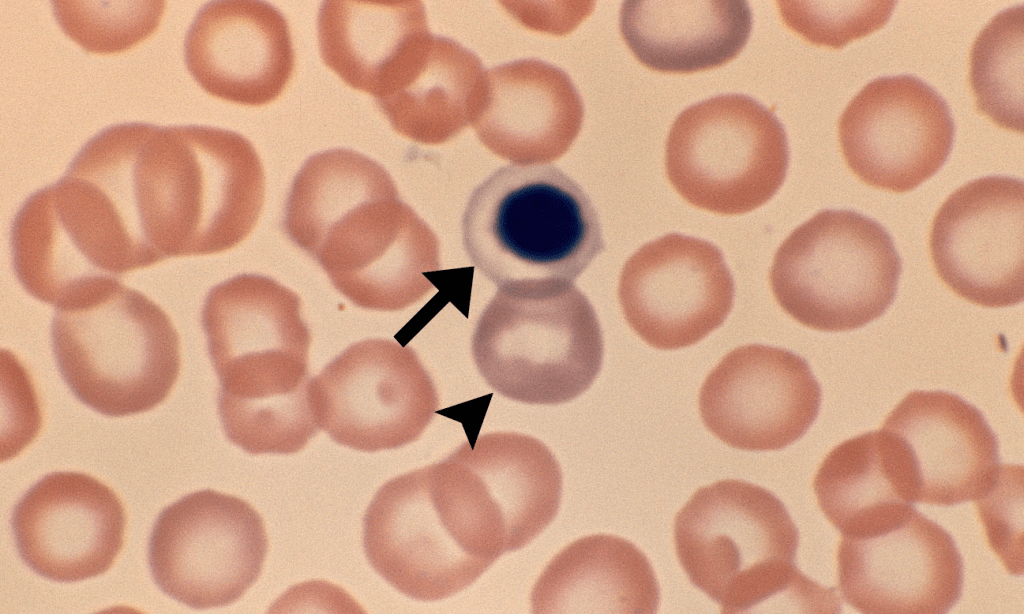 Nucleated Red Blood Cells – Cells and Smears