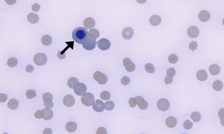Nucleated Red Blood Cells – Cells and Smears