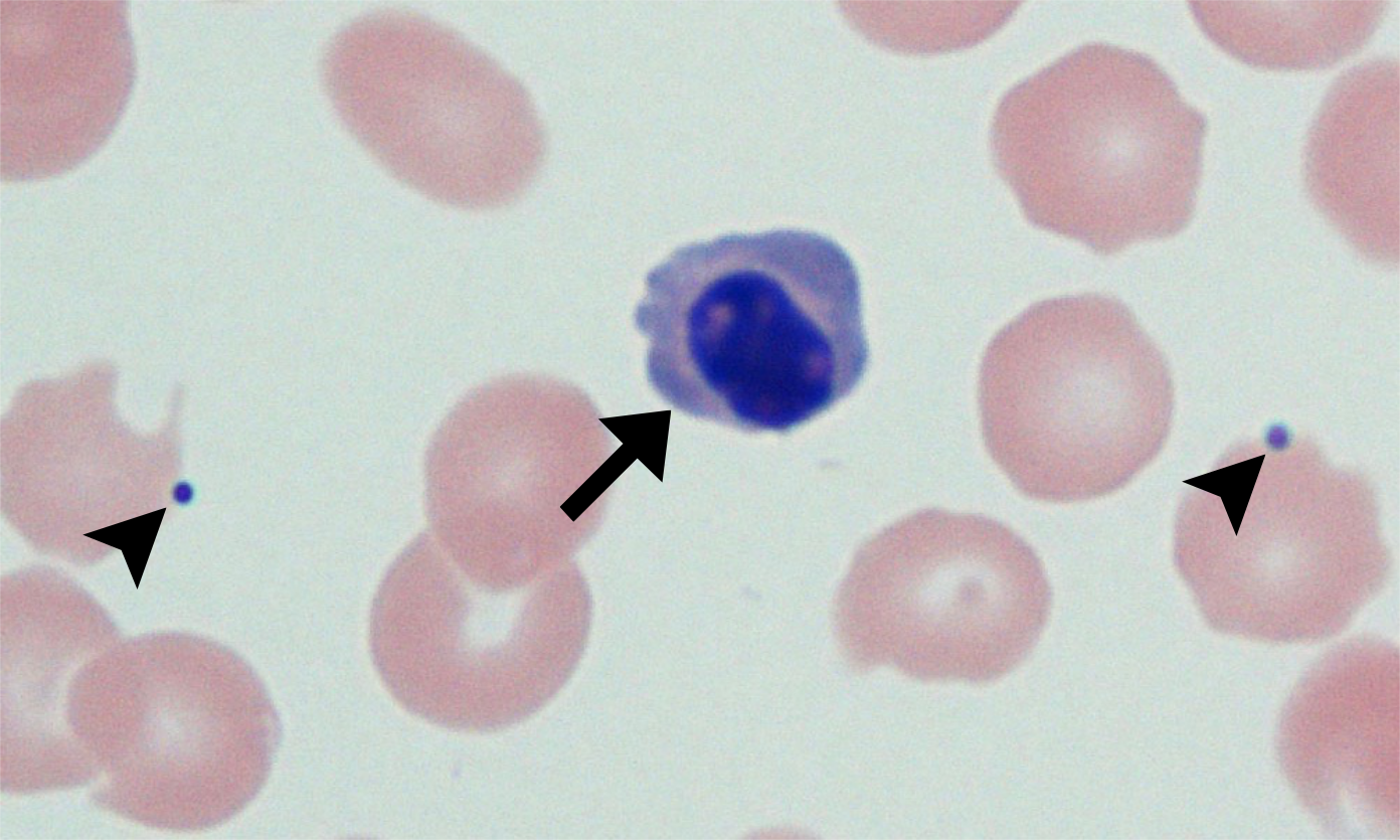 Nucleated Red Blood Cells – Cells and Smears