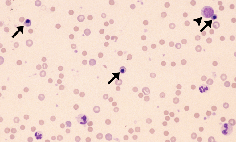 Nucleated Red Blood Cells – Cells and Smears