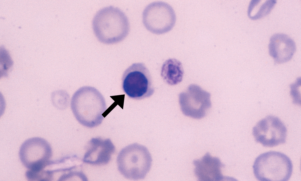 Nucleated Red Blood Cells – Cells and Smears