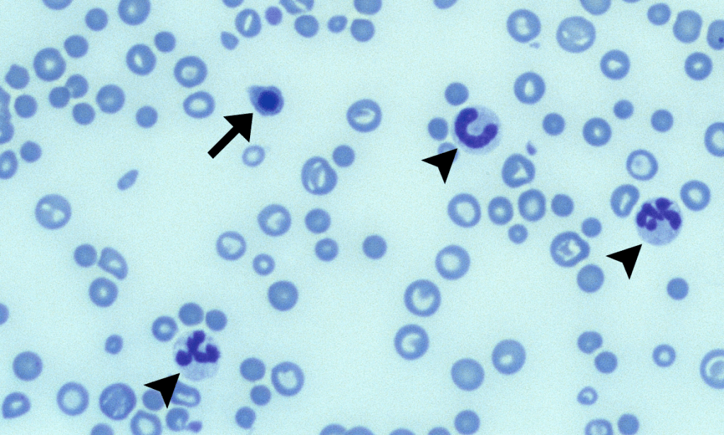 Nucleated Red Blood Cells – Cells and Smears