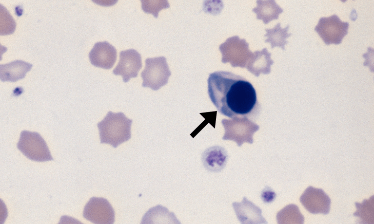 Nucleated Red Blood Cells – Cells and Smears