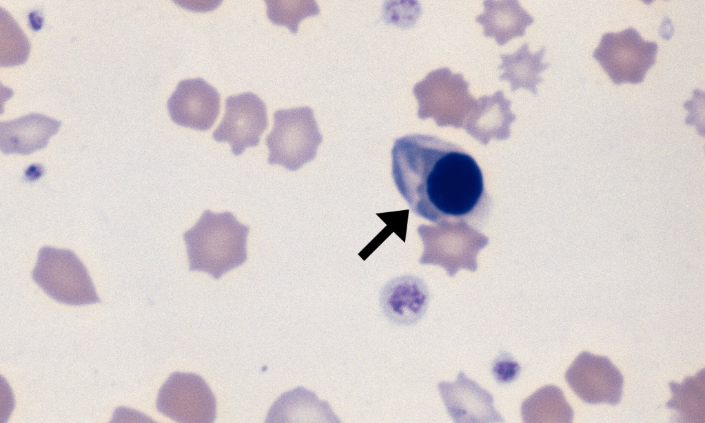 Nucleated Red Blood Cells – Cells and Smears