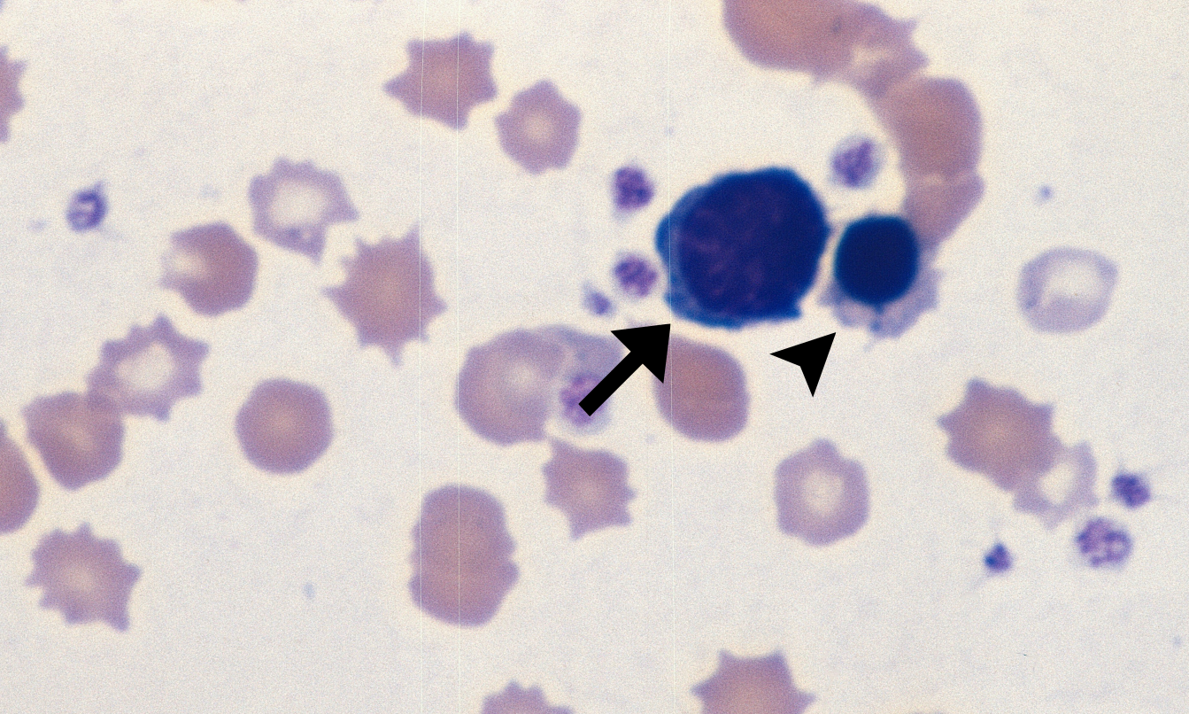 Nucleated Red Blood Cells – Cells and Smears