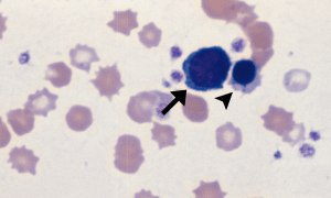 Nucleated Red Blood Cells – Cells and Smears