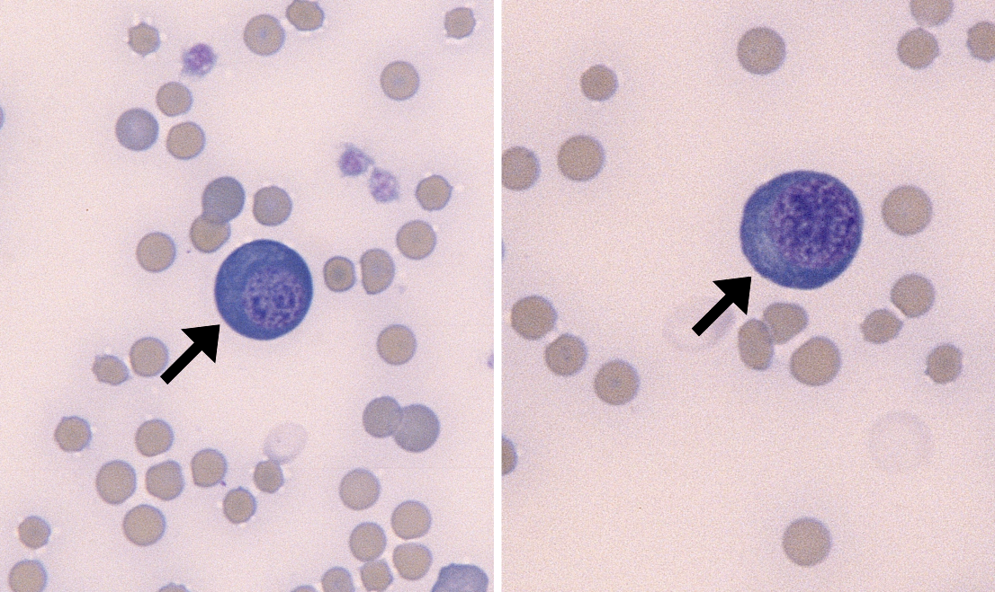 Nucleated Red Blood Cells – Cells and Smears