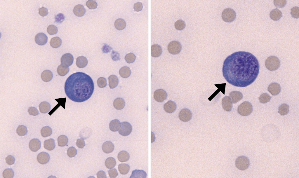 Nucleated Red Blood Cells – Cells and Smears