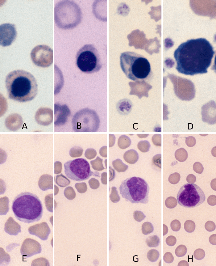 Nucleated Red Blood Cells – Cells and Smears
