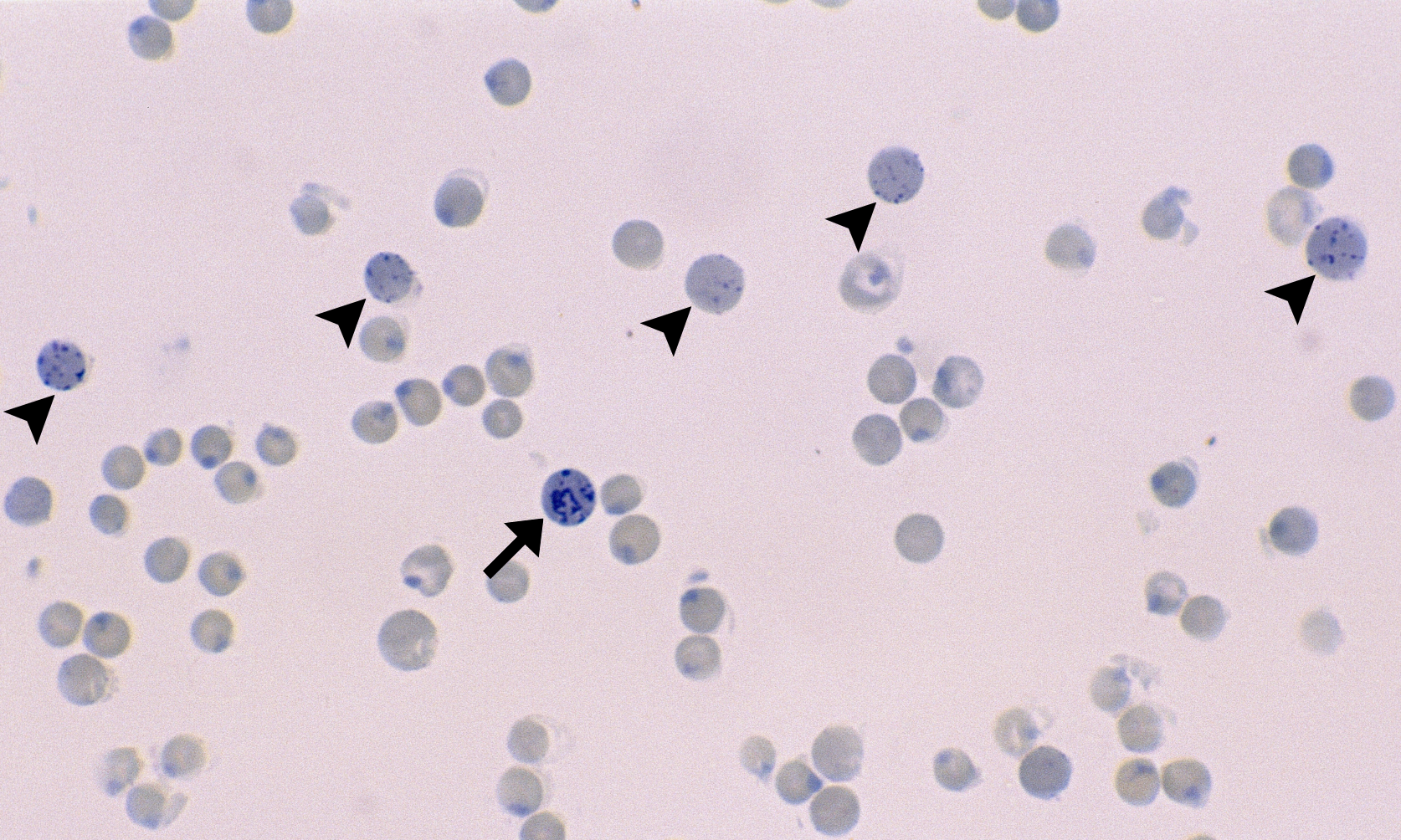 Reticulocytes – Cells and Smears