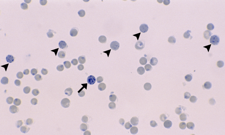 Reticulocytes – Cells and Smears