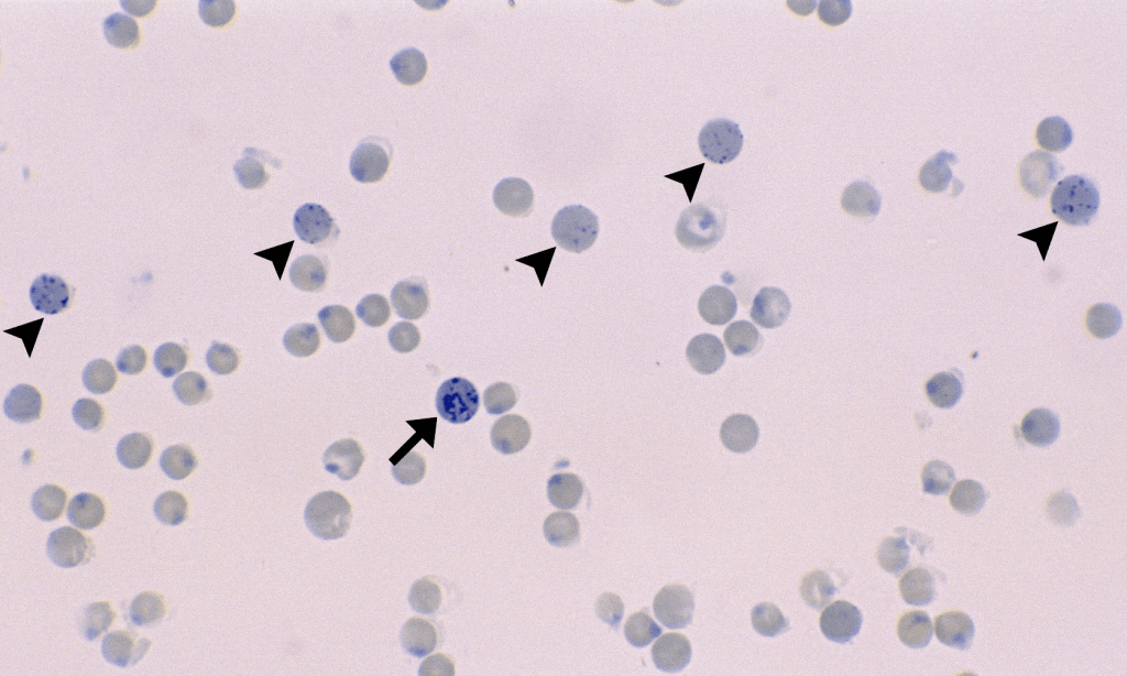 Reticulocytes – Cells and Smears