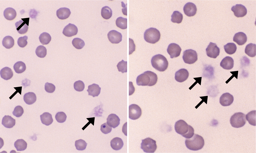 Normal Platelets – Cells and Smears