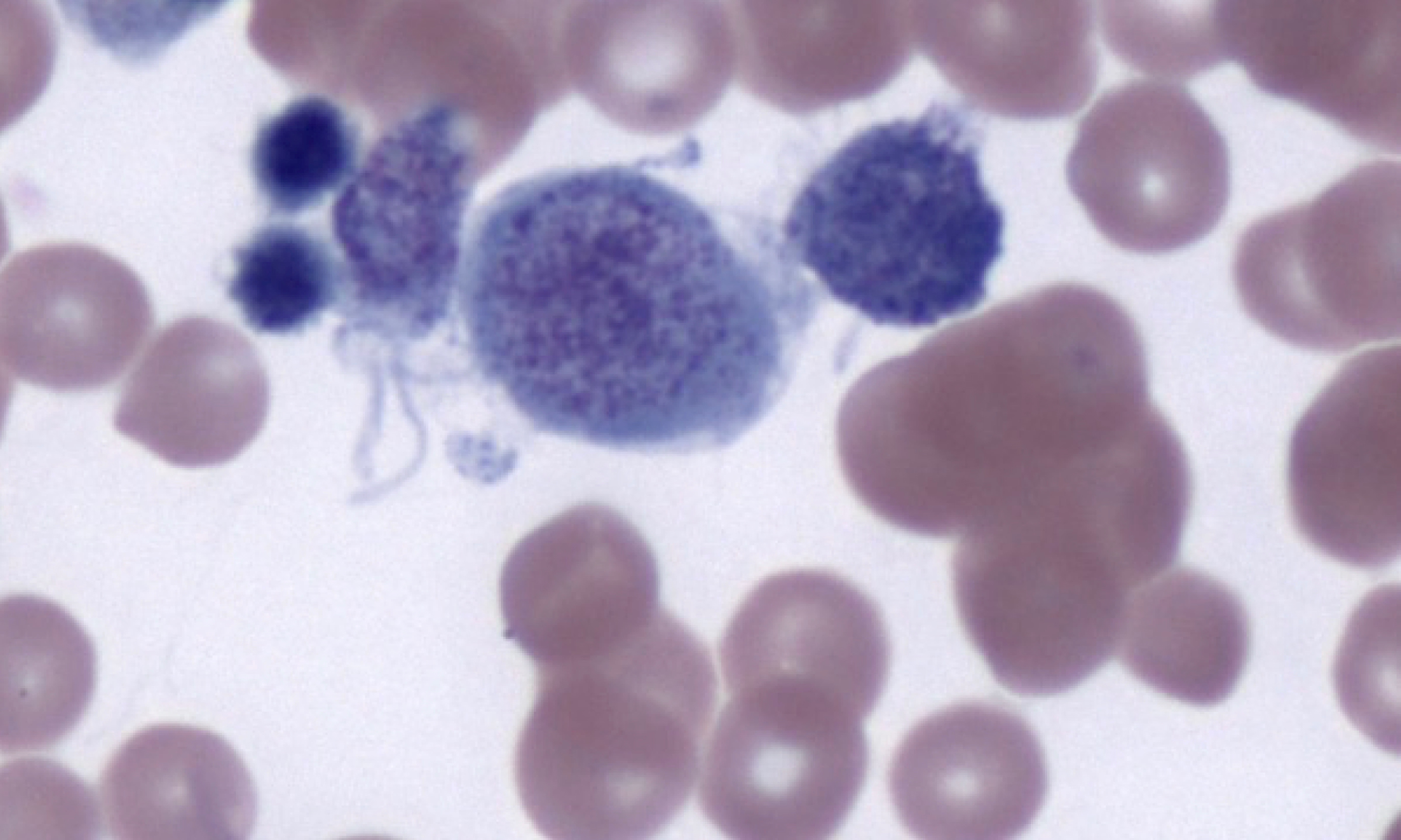 Giant Platelet – Cells and Smears