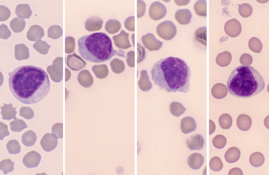 Cells and Smears – Page 2 – Veterinary Clinical Pathology Digital Database