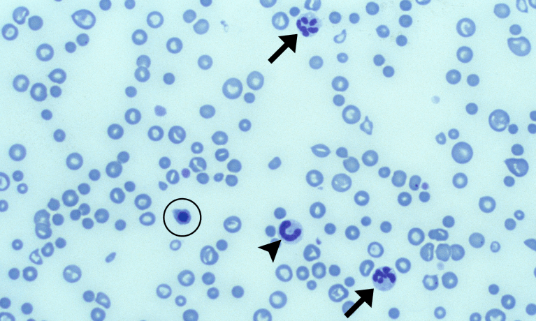 Neutrophils – Cells and Smears