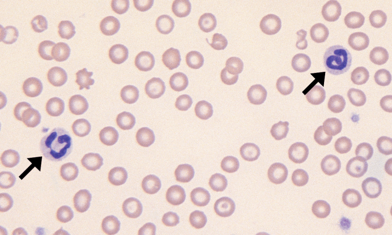 Neutrophils – Cells and Smears