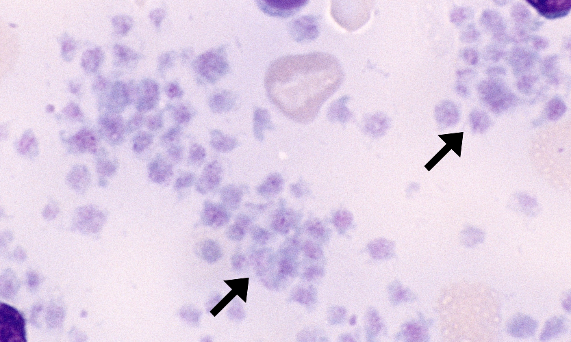 Platelet Clumps – Cells and Smears