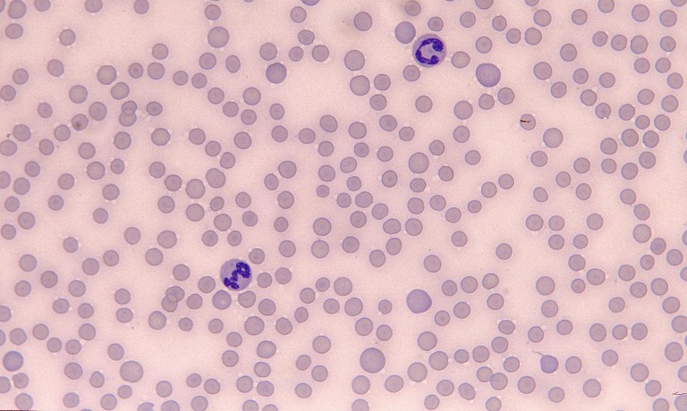Normal Platelets – Cells and Smears