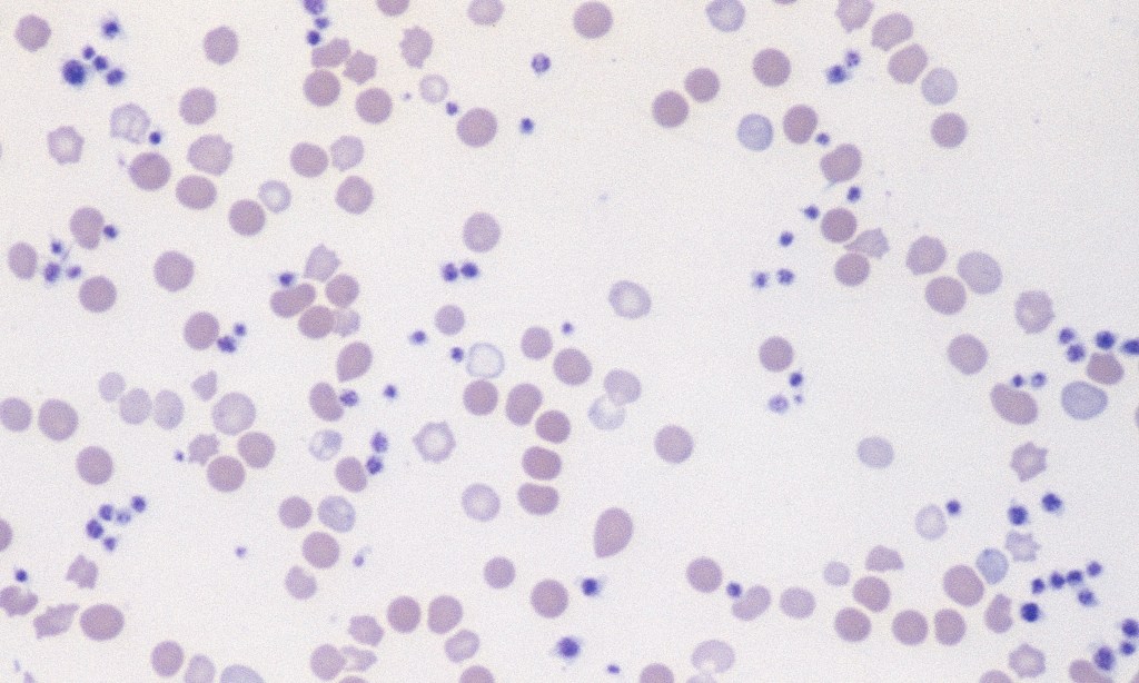 Normal Platelets – Cells and Smears