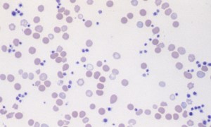 Normal Platelets – Cells and Smears