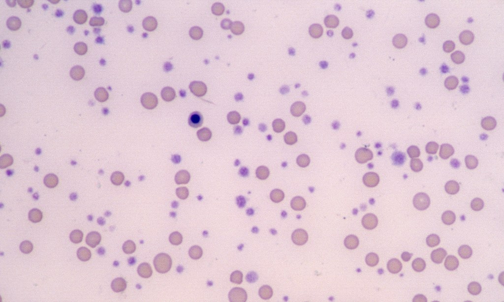 Normal Platelets – Cells and Smears