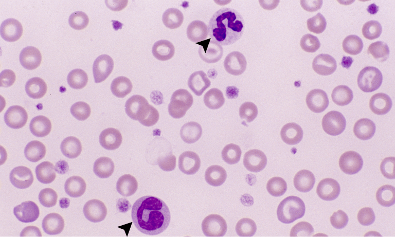Normal Platelets – Cells and Smears