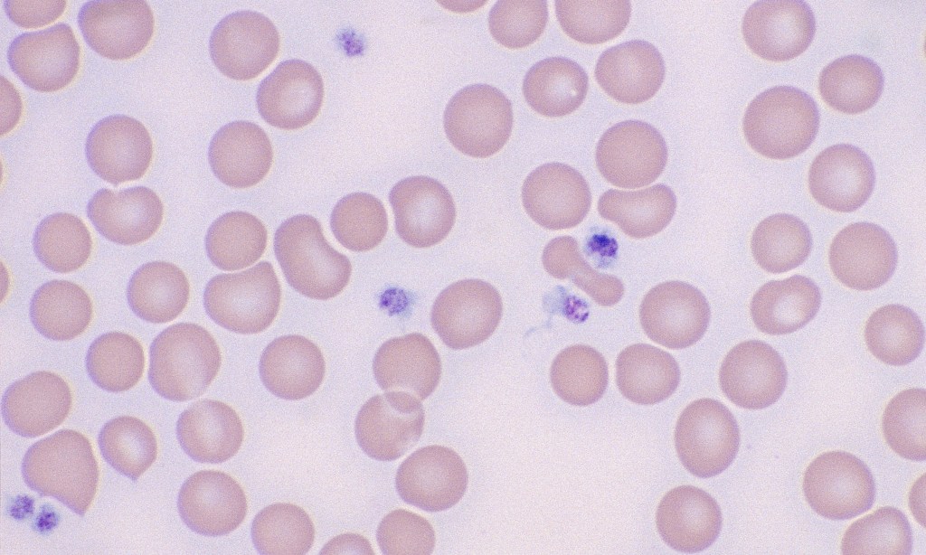 Normal Platelets – Cells and Smears