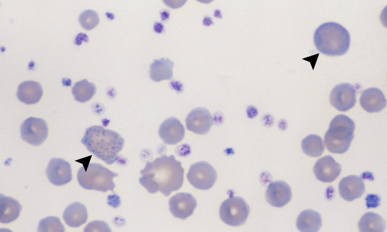 Normal Platelets – Cells and Smears