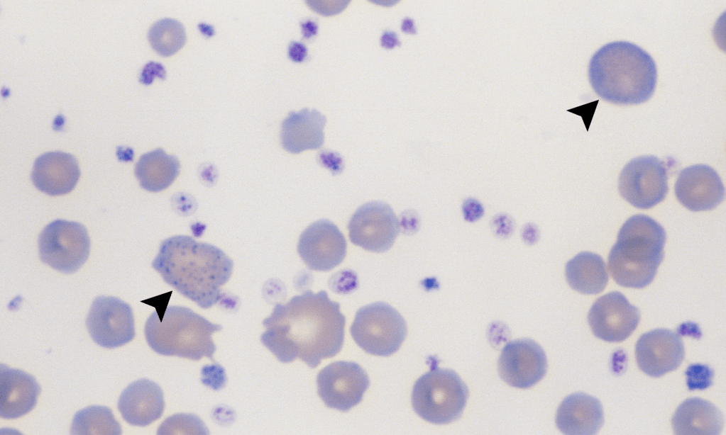 Normal Platelets – Cells and Smears