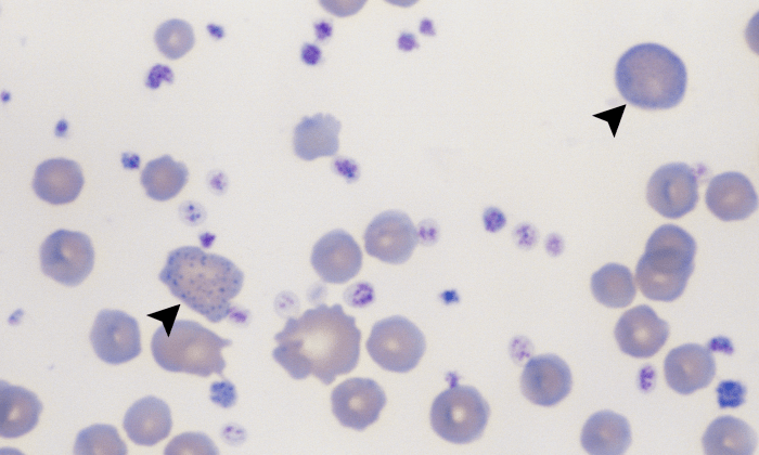 Normal Platelets – Cells and Smears