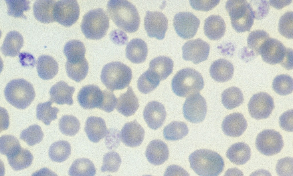 Normal Platelets – Cells and Smears