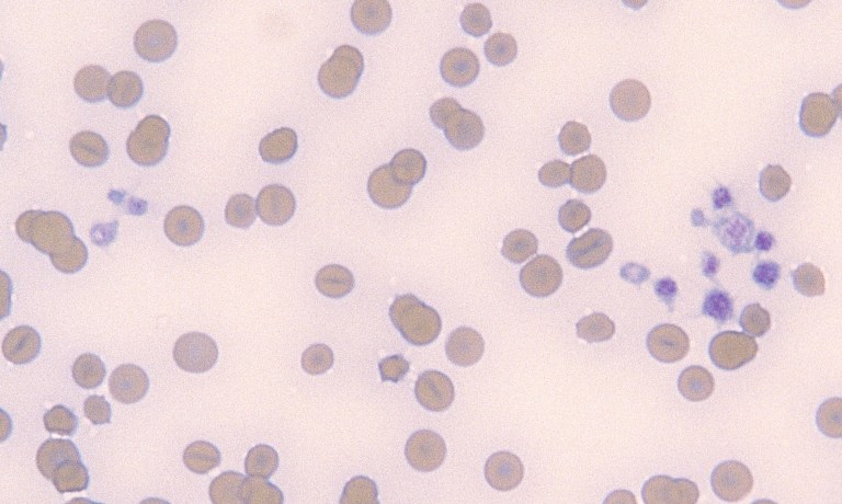 Normal Platelets – Cells and Smears