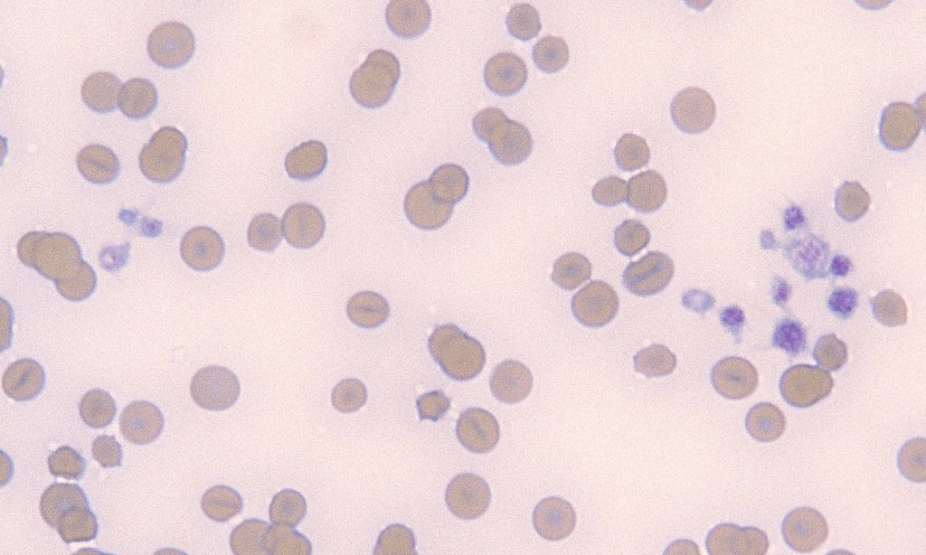Normal Platelets – Cells and Smears
