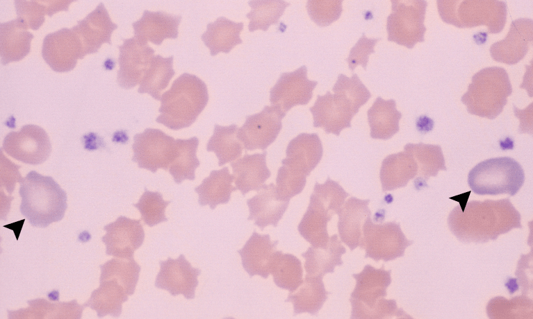Normal Platelets – Cells and Smears